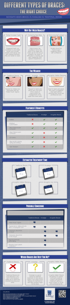 Different Types of Braces Infographic